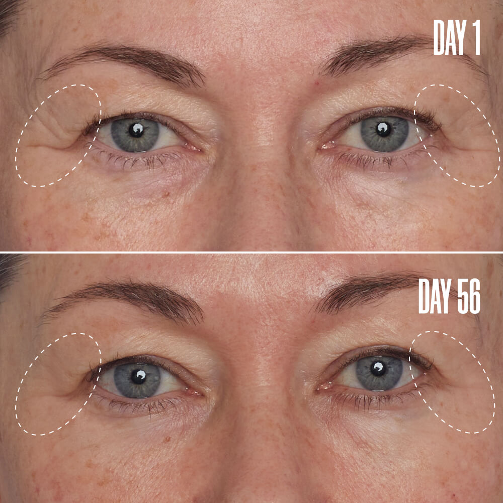 TOO-FINE Clinically Proven Face Sculpting Serum | MAЁLYS®